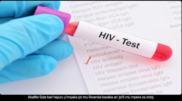 Abagera kuri 30% y’abafite Virusi itera Sida mu Rwanda bari hejuru y ...